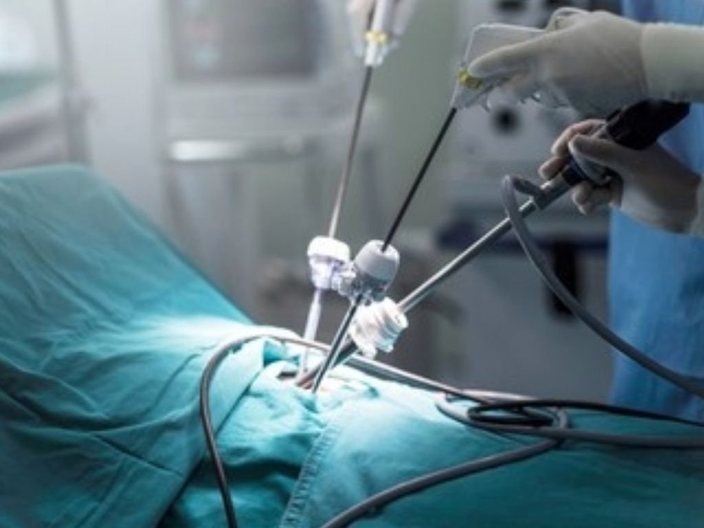 Laparoscopic Surgery – sinaclinic.net